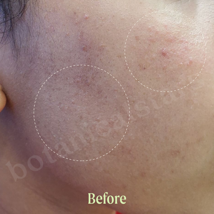 Clearing Your Skin Should Be Easy & Intention-Filled – Botanical Stars